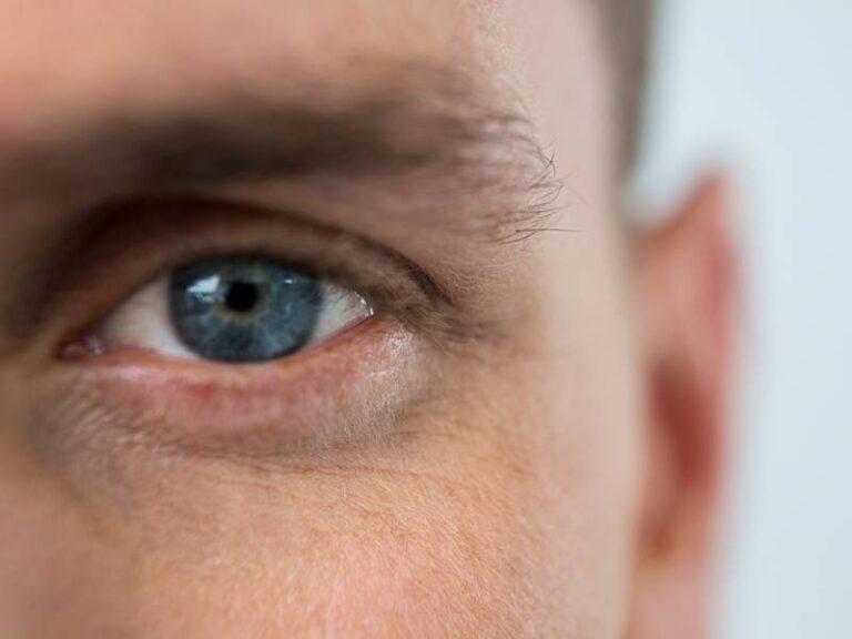 What Causes a Droopy Upper Eyelid? - Consultants in Ophthalmic and ...